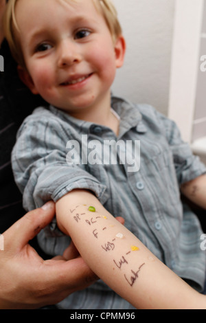 ALLERGY TEST, CHILD Stock Photo - Alamy