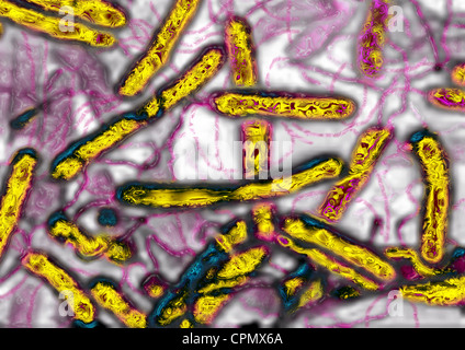 Illustration of Helicobacter pylori bacteria, a gram-negative spiral ...