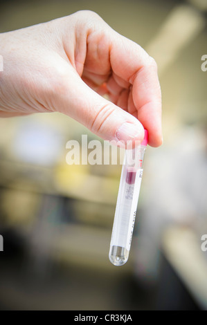 A test tube labeled SARS-CoV-2 on brown eggs in a carton Stock Photo ...