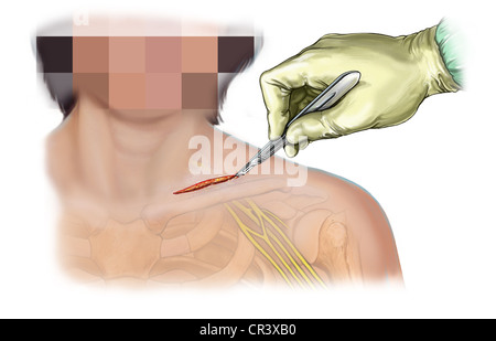 The brachial plexus Stock Photo - Alamy