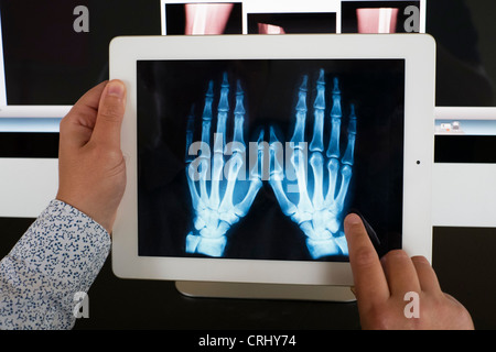 Doctor using iPad app to view xray images of patient Stock Photo - Alamy