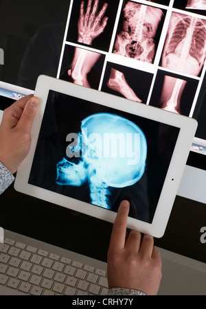 Doctor using iPad app to view xray images of patient Stock Photo - Alamy