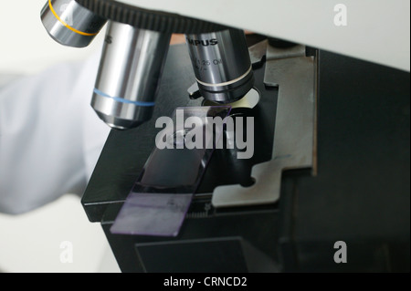 A close up of haematology slides Stock Photo - Alamy