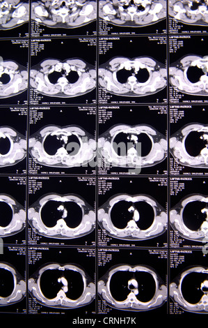 Cat scan of the cerebral cortex Stock Photo - Alamy