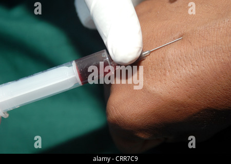 Blood sample being taken from veins in arm for blood test. This image ...