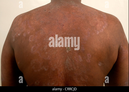 Woman suffering from upper back, isolated on white Stock Photo - Alamy