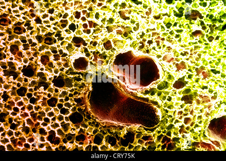 Scanning electron micrograph (SEM) of the bronchus wall, consisting in ...