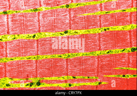 SKELETAL MUSCLE, TEM Stock Photo - Alamy