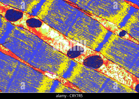 SKELETAL MUSCLE, TEM Stock Photo - Alamy