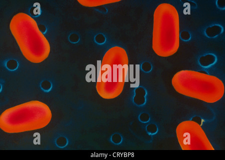 Electron micrograph of Haemophilus influenzae bacteria Stock Photo - Alamy