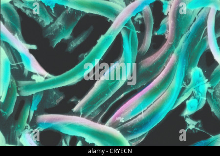 Collagen. Scanning electron micrograph (SEM) of collagen bundles from ...