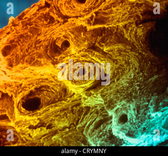COMPACT BONE, SEM Stock Photo - Alamy