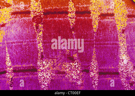 TEM of Skeletal Muscle Stock Photo - Alamy