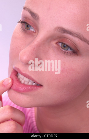 APHTHA IN A WOMAN Stock Photo - Alamy