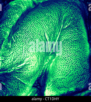 GALLBLADDER MUCOSA, SEM Stock Photo - Alamy