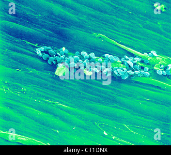 RABBIT PLATELET, SEM Stock Photo - Alamy