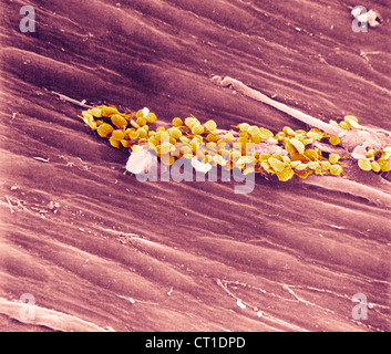 RABBIT PLATELET, SEM Stock Photo - Alamy