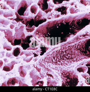 LUNG ALVEOLUS, SEM Stock Photo - Alamy