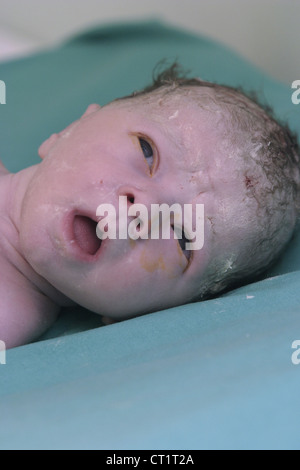 New born baby with vernix caseosa Stock Photo - Alamy