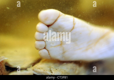 The body of a foetus preserved in formaldehyde Stock Photo - Alamy