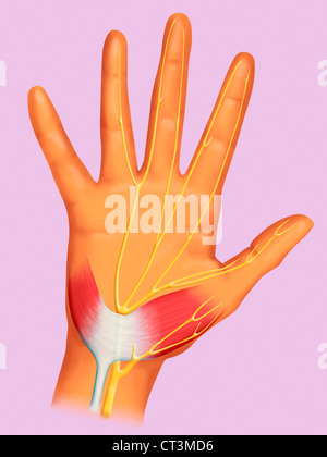 CARPAL TUNNEL, DRAWING Stock Photo - Alamy