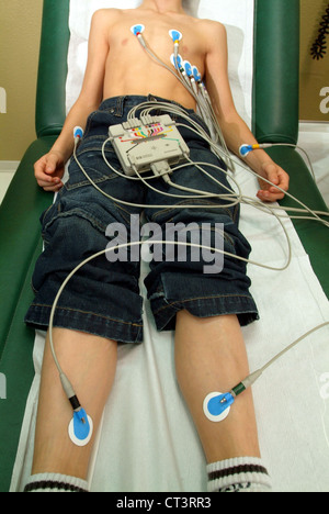 ECG OF AN ADOLESCENT Stock Photo - Alamy