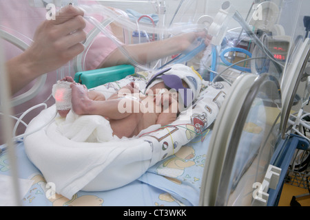 NEONATAL JAUNDICE, PHOTOTHERAPY Stock Photo - Alamy
