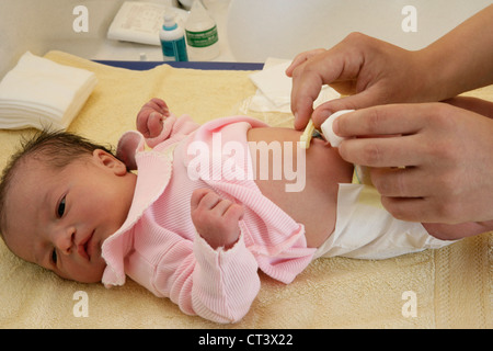 Umbilical cord with clamp of newborn baby, 7 days old Stock Photo ...