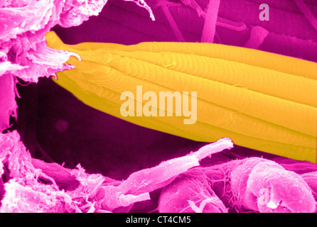 SKELETAL MUSCLE, SEM Stock Photo - Alamy