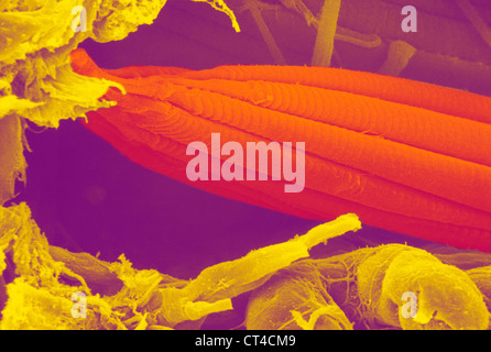 Electron micrograph of striated muscle tissue Stock Photo - Alamy