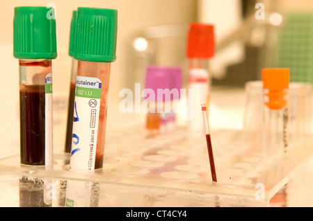 The erythrocyte sedimentation rate (ESR) test Stock Photo: 19780846 - Alamy