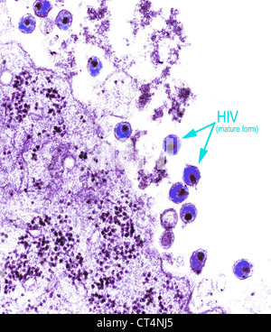 TEM Transmission Electron Microscope of AIDS virus Stock Photo - Alamy