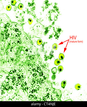 TEM Transmission Electron Microscope of AIDS virus Stock Photo - Alamy