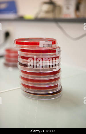 blood agar culture plate growing Bacillus anthracis (anthrax Stock ...