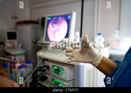 COLON BIOPSY Stock Photo - Alamy