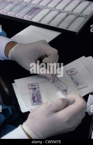 Microscope slide preparation. Close-up of a student preparing an onion ...