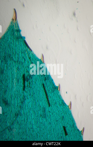 science microscopy micrograph black algae leaf Hydrilla verticillata ...