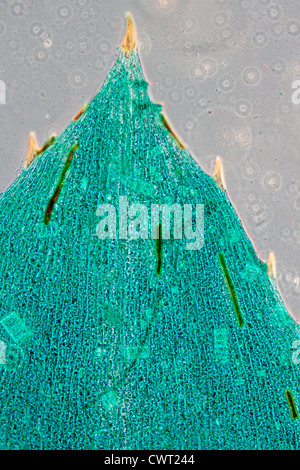 science microscopy micrograph black algae leaf Hydrilla verticillata ...