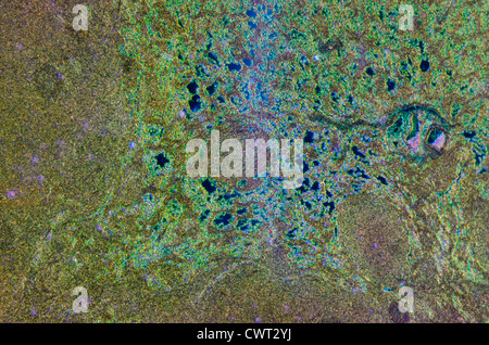 Lymph Node Anatomy as a cross section of the gland of the Lymphatic ...