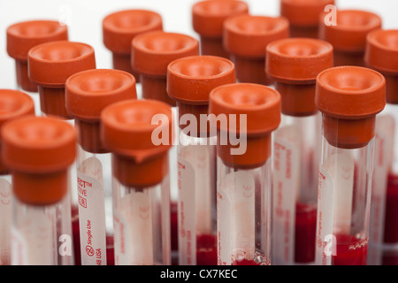 Detail of blood samples tubes at a red cross blood bank in San Salvador ...