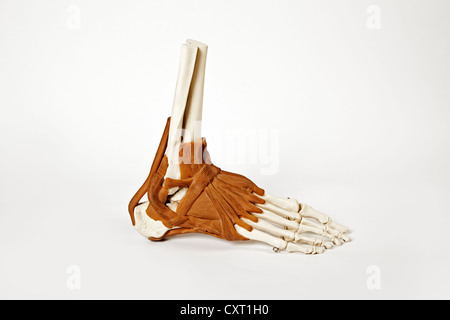 Anatomical model of the bones of the human foot wearing an orthopedic ...