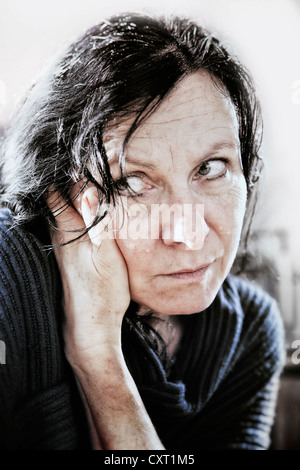 Bruise injury on the female arm background Stock Photo - Alamy