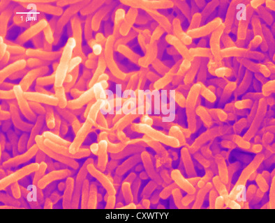 Scanning electron micrograph (SEM) of Vibrio cholerae bacteria of the ...