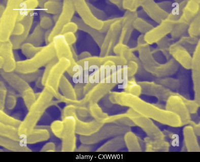Scanning electron micrograph (SEM) of Vibrio cholerae bacteria, This ...