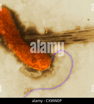 Cholera bacteria. Coloured scanning electron micrograph (SEM) of Vibrio ...