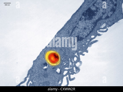 Transmission Electron Micrograph (TEM) of a single strand of ...