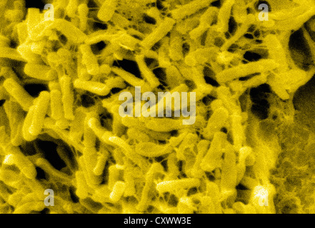 Scanning electron micrograph (SEM) of Clostridium difficile (long cell ...