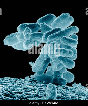 Scanning electron micrograph (SEM) of a cluster of Escherichia coli ...