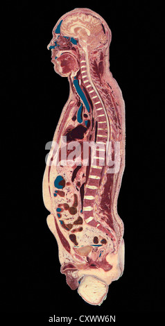 A model of the cross section of the human torso revealing organs and ...