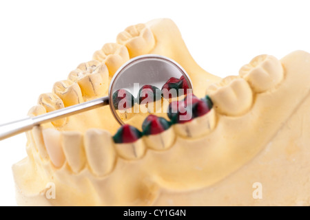 Denture cast model and dental tools set Stock Photo - Alamy